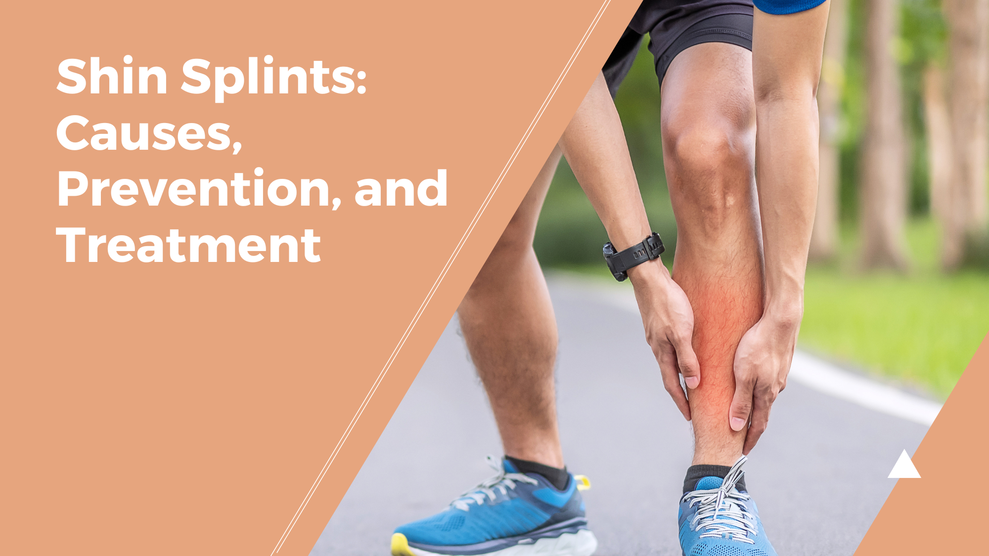 Shin Splints Causes Symptoms Treatment And Prevention - vrogue.co